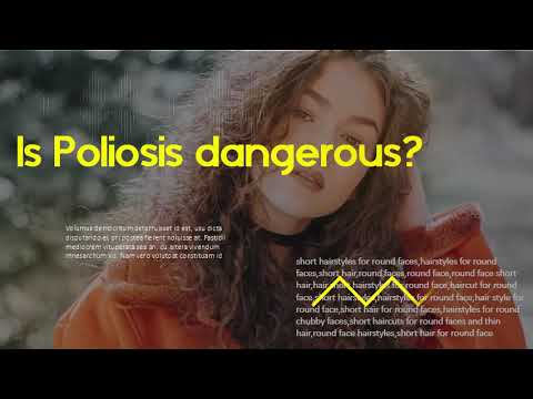 Causes For White Hair Patch Or Poliosis Of Hair? Is Poliosis dangerous ...