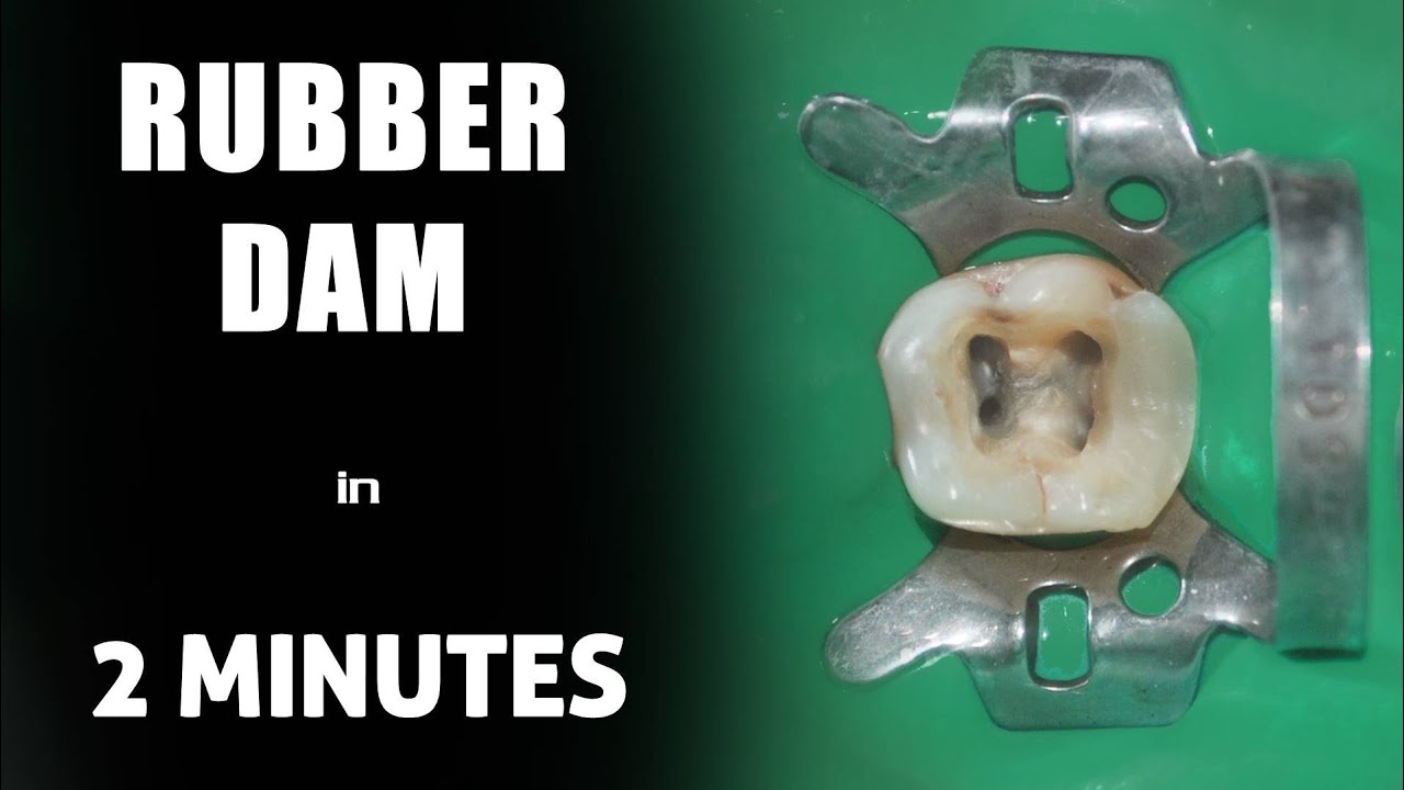 Rubber dam - YouTube