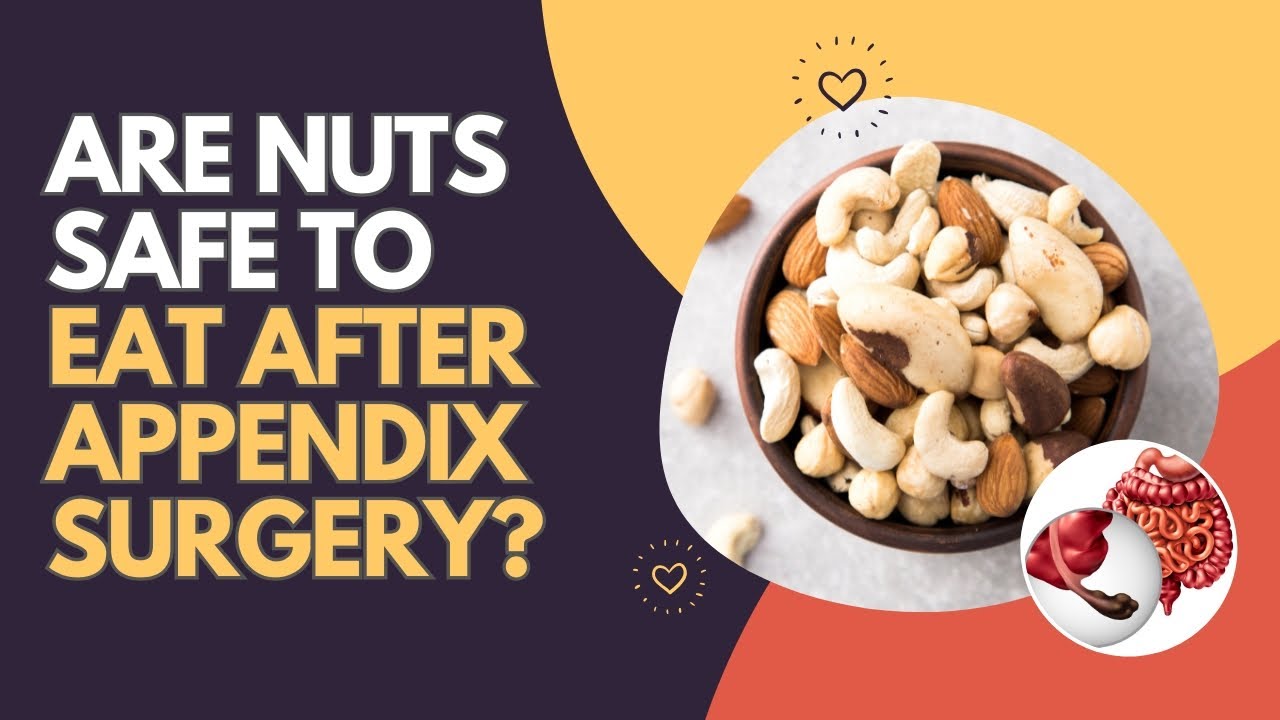 Are Nuts Safe to Eat After Appendix Surgery? - YouTube