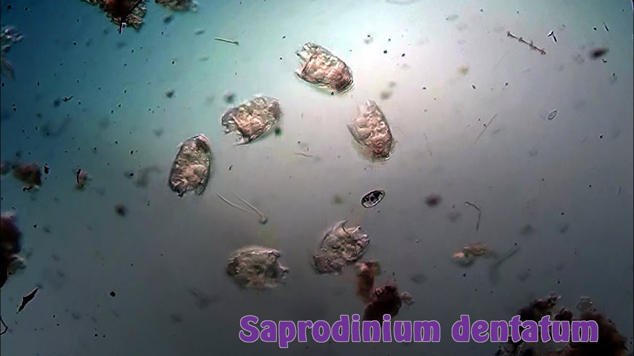 Saprodinium dentatum - YouTube