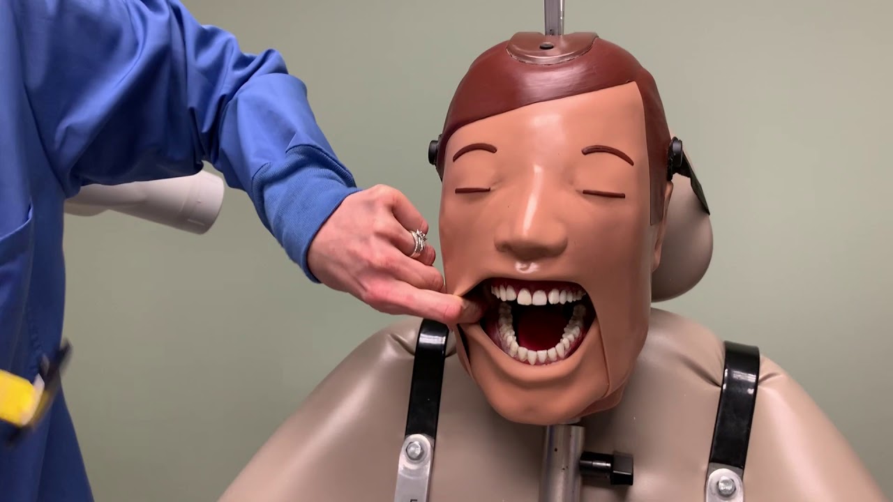 Maxillary posterior periapical radiograph using PSP plate. - YouTube