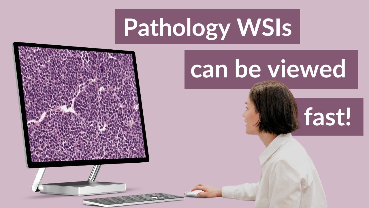 How to make a fast whole slide image viewer for pathology? - YouTube