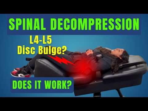L4-L5 Disc Bulge: Does Non-Surgical Spinal Decompression ACTUALLY WORK ...