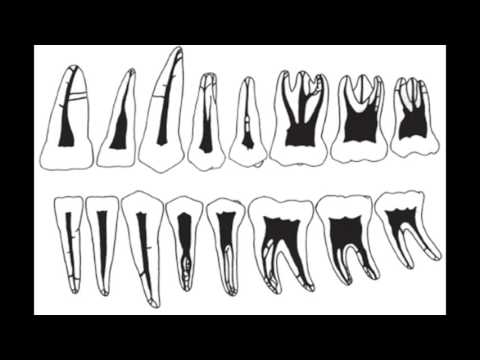 Anatomia dental Caninos temporales - YouTube