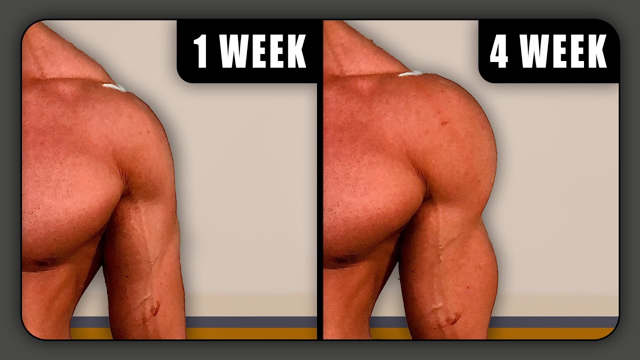 Fix Arms In 30 DAYS ! ( HOME WORKOUT ) - YouTube