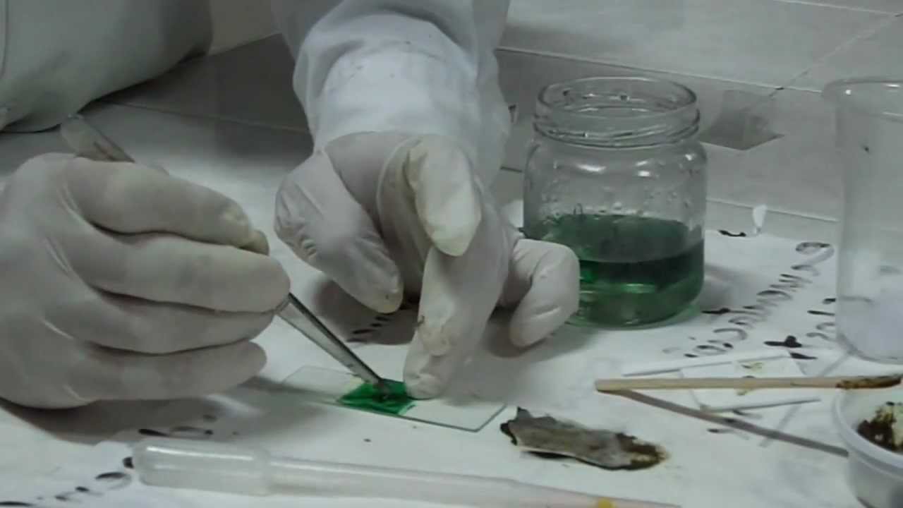 Parasitologia UNT - KATO KATZ - YouTube