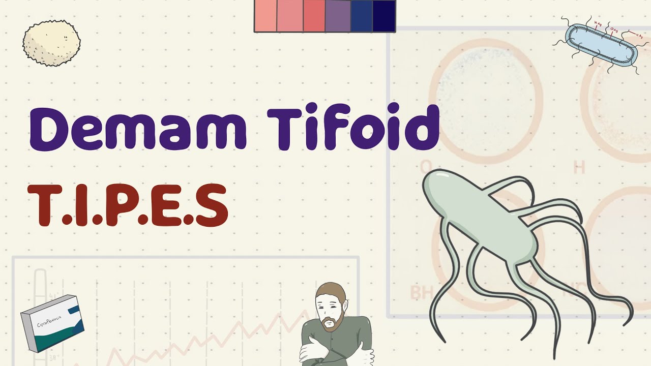 Demam Tifoid atau Tipes Patofisiologi, Tanda Gejala, Tatalaksana - YouTube