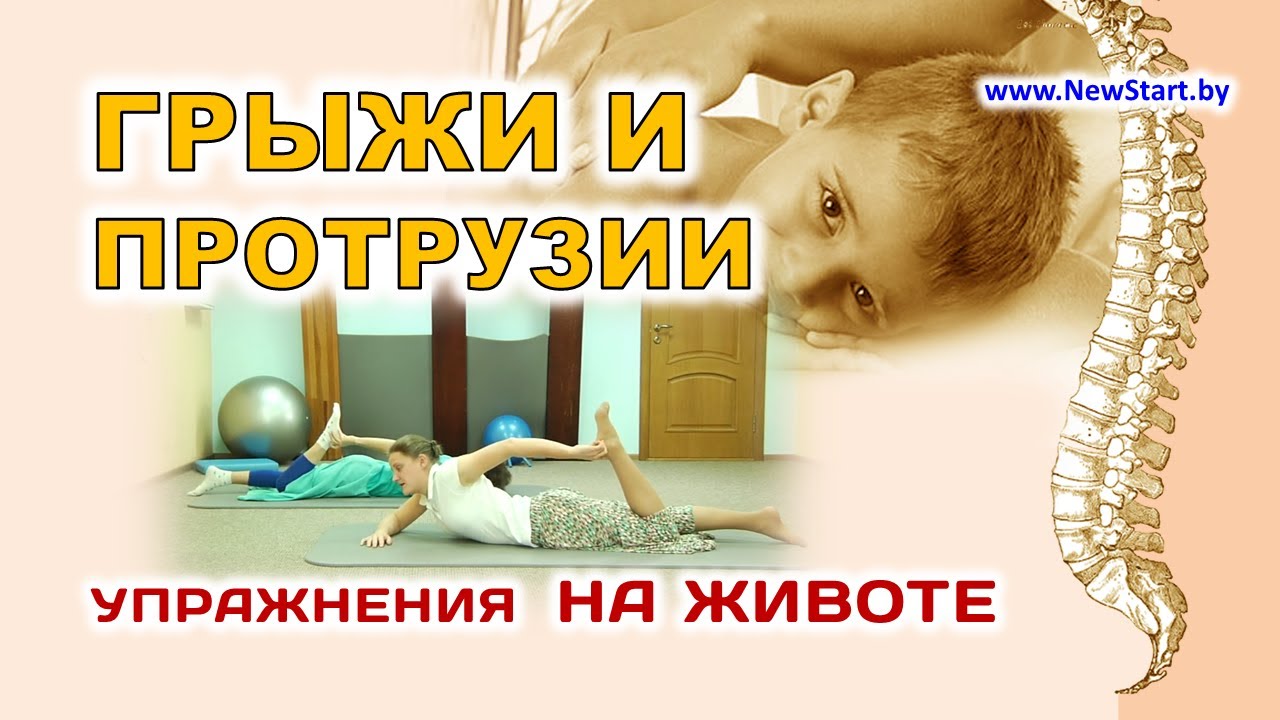 Грыжи, протрузии | №6 - Упражнения на животе | Кинезитерапия (ЛФК ...