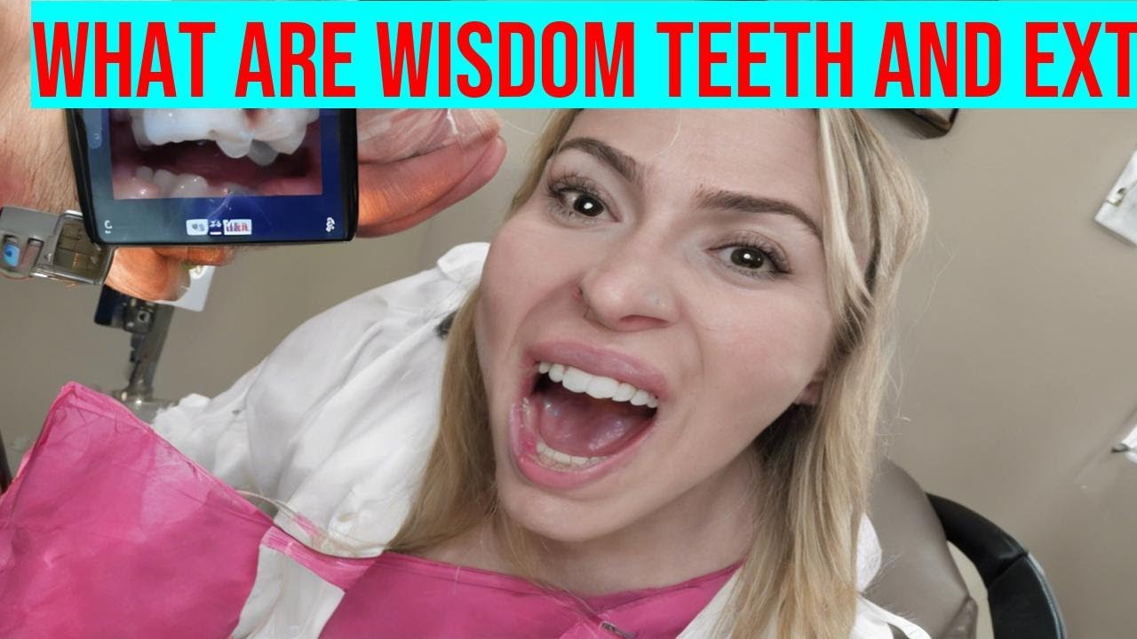 Say Goodbye to Wisdom Teeth - Is Wisdom Tooth Extraction Necessary ...