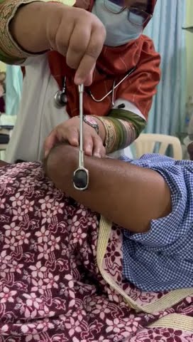 TRICEPS REFLEX on left hand - YouTube