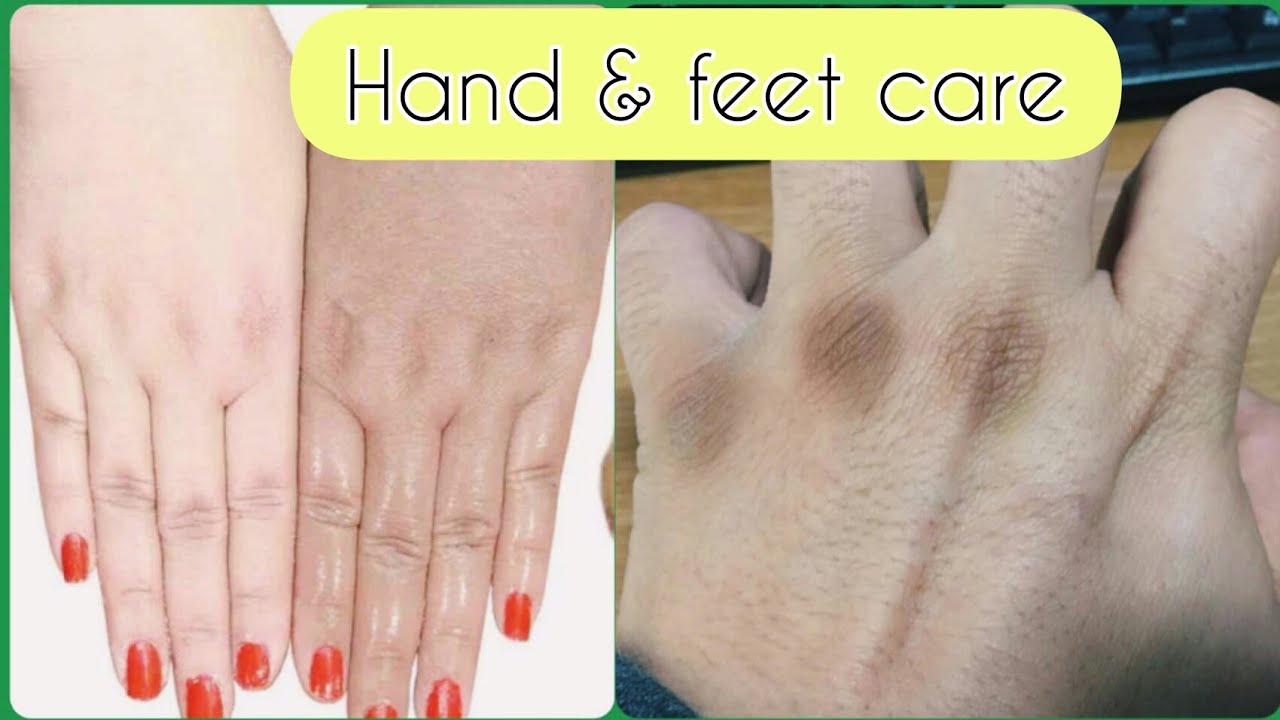 Hand And Feet Care At Home|| How to Get Rid Of Sun Tan In Winter ...