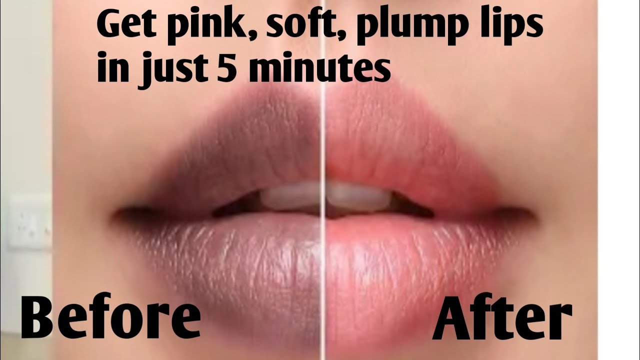 How to get pink,soft &plump lips|How to get rid of black & cracked lips ...