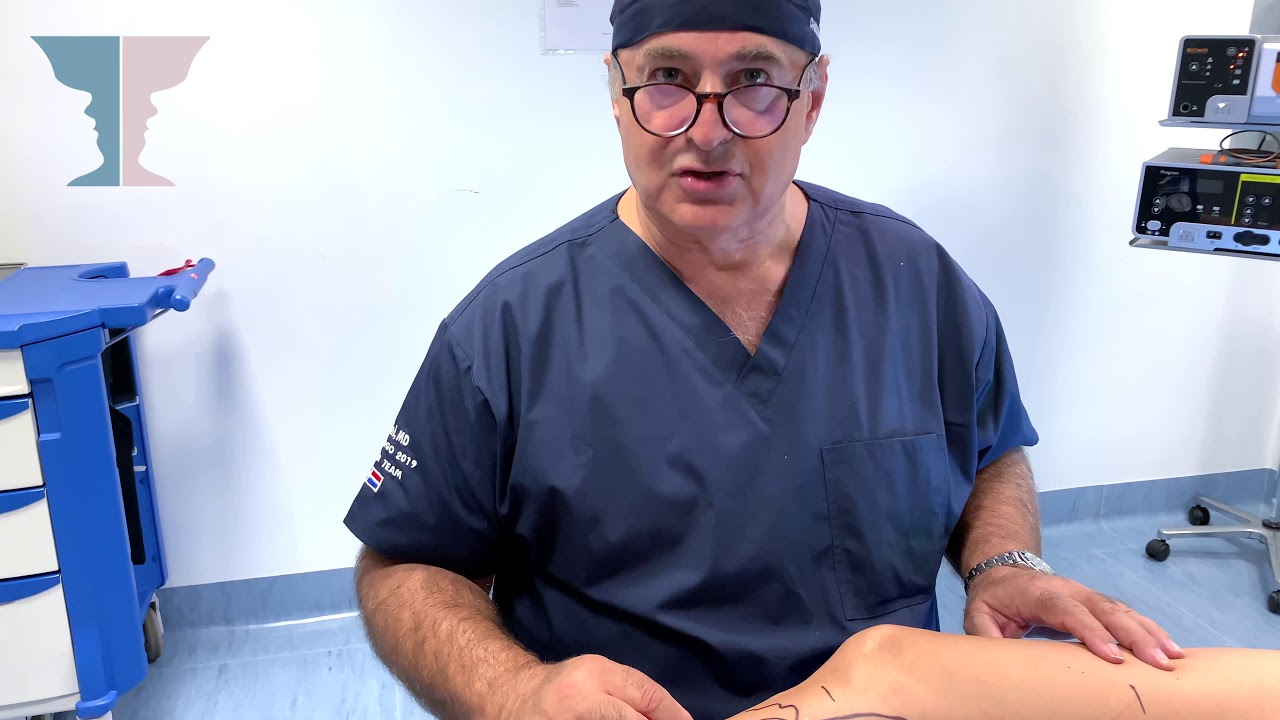 Pro-Clinic | Dott. Francesco Zini | Vena Safena - YouTube