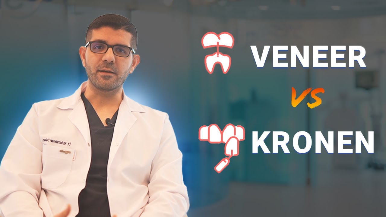 Veneers vs. Kronen - Was ist die bessere Wahl für Ihre Zahnästhetik ...