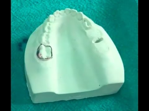 Band Fabrication Demonstration: Dr. Amita Rai, 2018 - YouTube