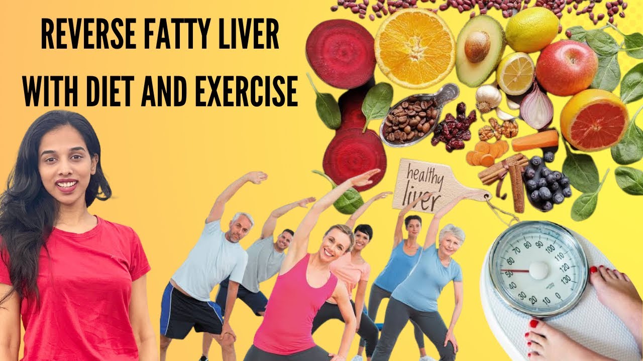 Fatty Liver and How to reverse it through diet and exercise | Dr Aparna ...