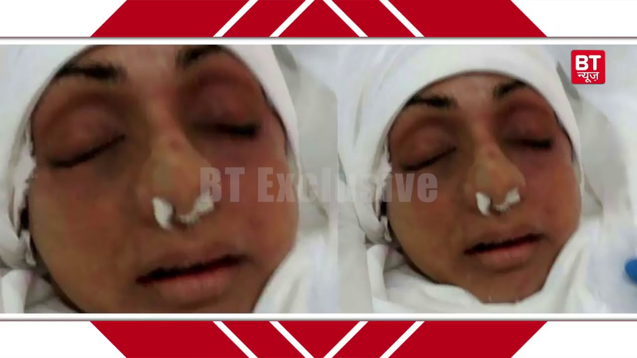 Sridevi Exclusive Photo Sridevi Dead Body 1st Exclusive Pic - YouTube