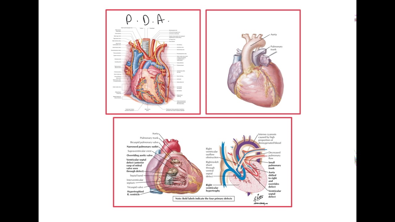 Heart development 5 - YouTube