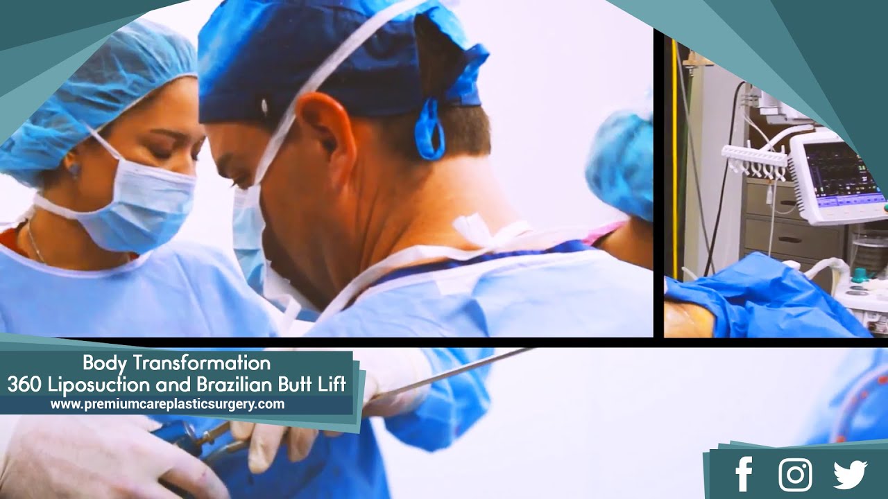 Body Transformation -- 360 Liposuction and Brazilian Butt Lift - YouTube