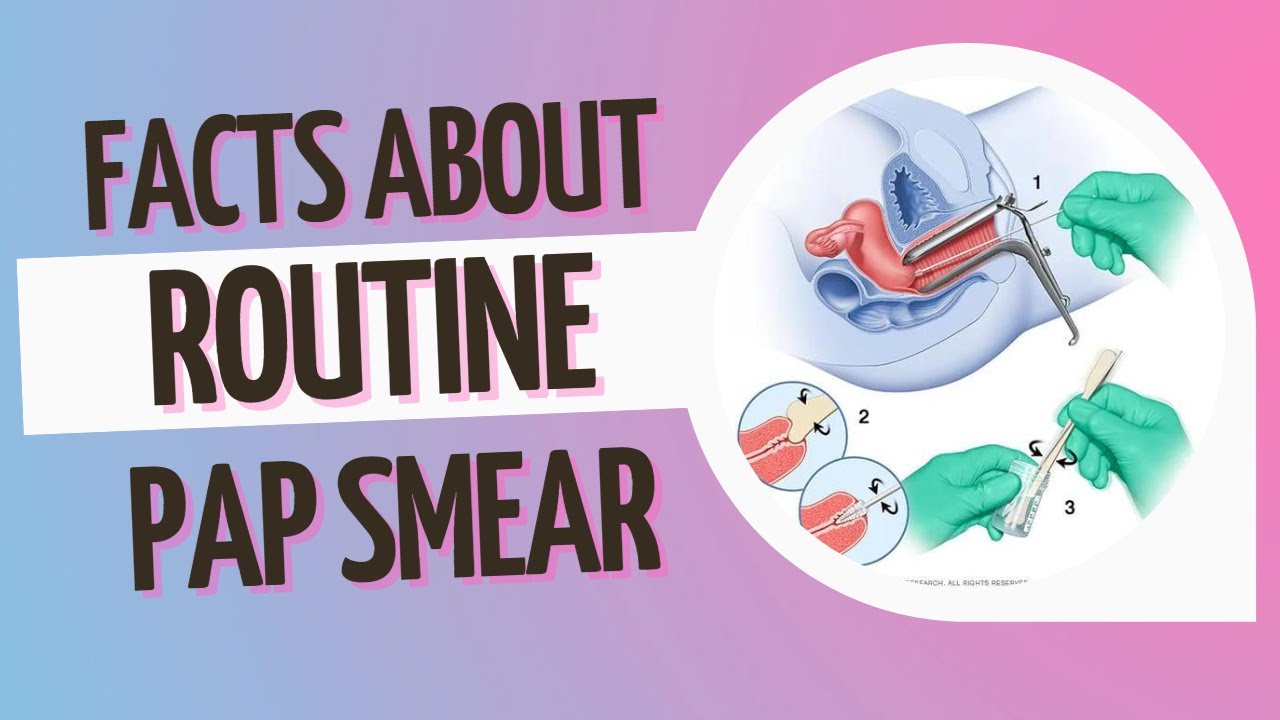 Quick facts about pap smear - YouTube