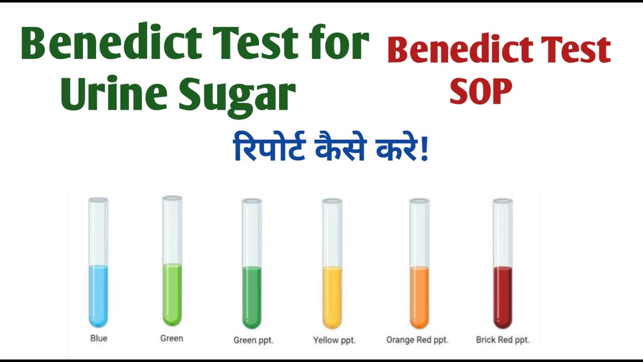 urine benedict test - YouTube