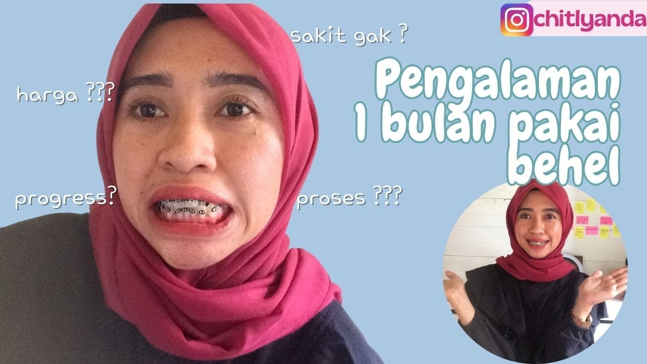 Pengalaman pakai behel selama 1 bulan || harga, proses dan progres ...