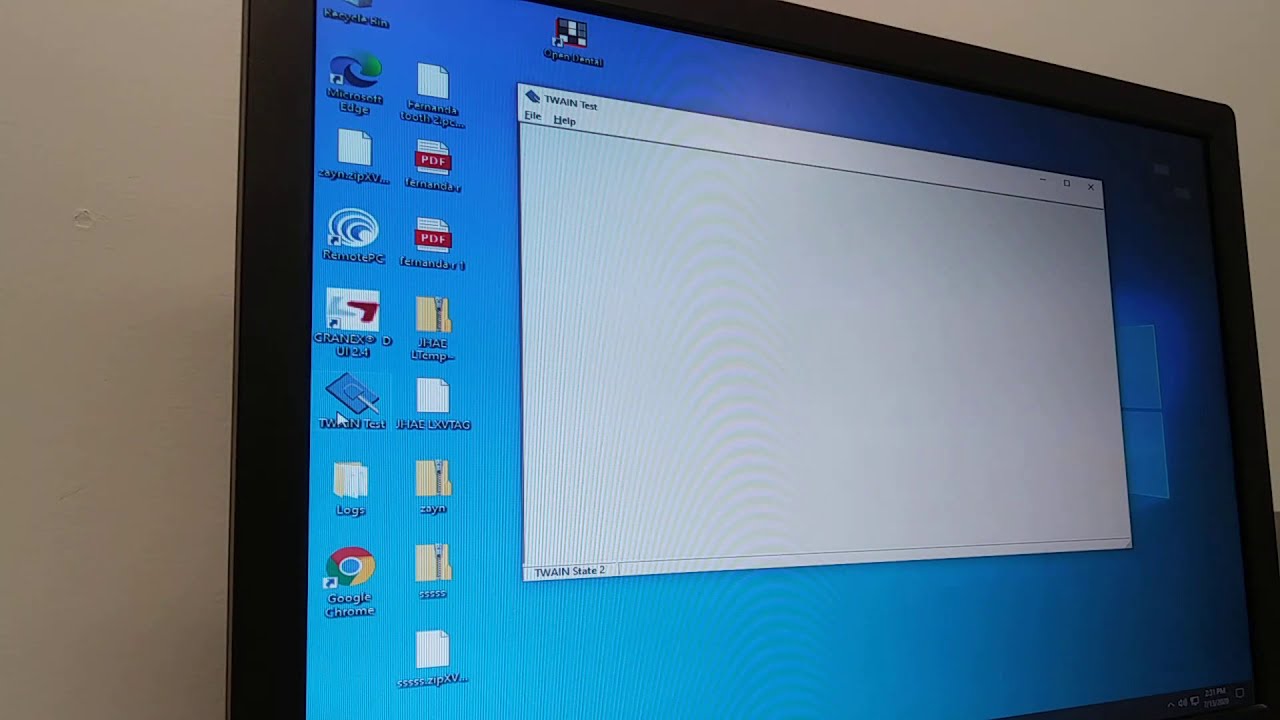 Digora Optime X-ray Sensor - YouTube