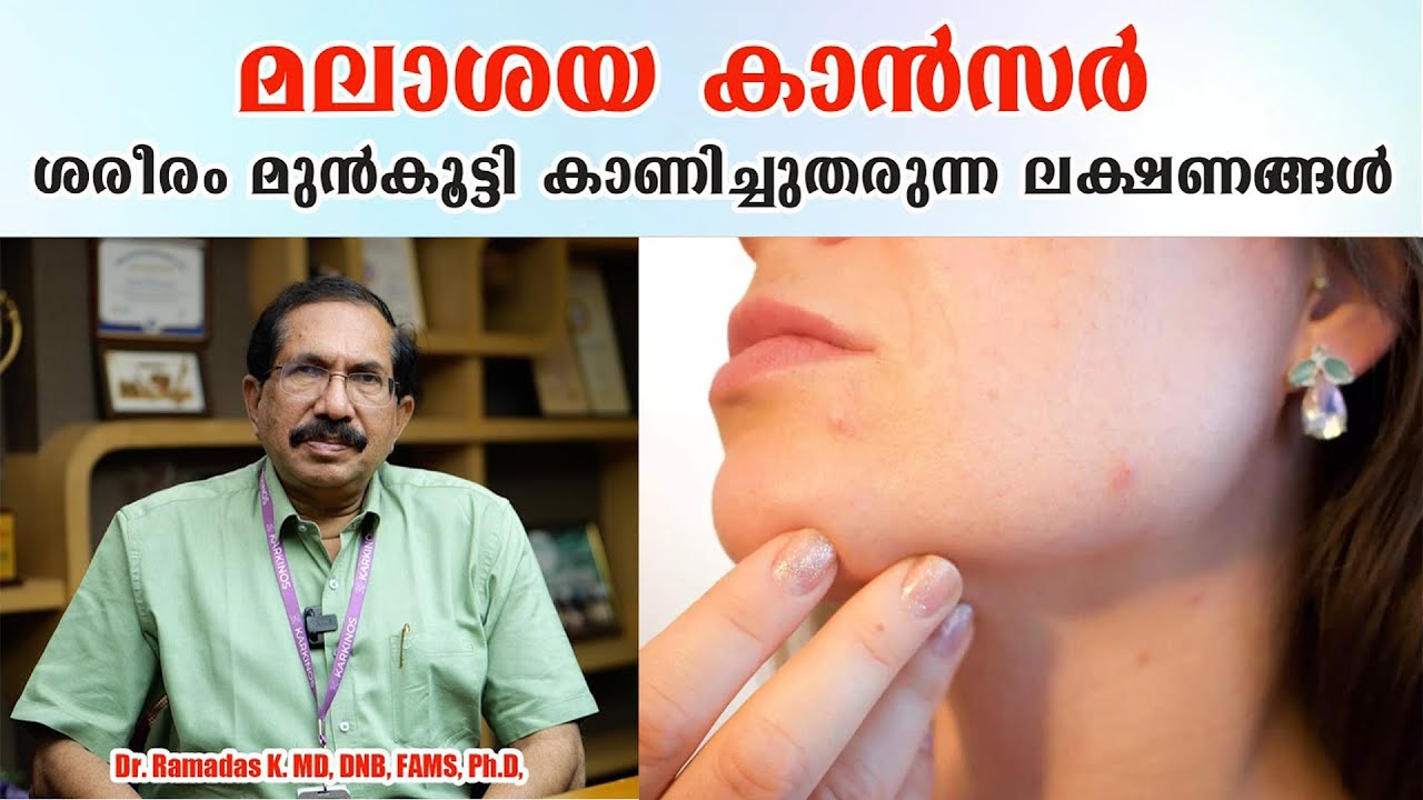 കാൻസർ ശരീരം മുൻകൂട്ടി കാണിച്ചുതരുന്ന ലക്ഷണങ്ങൾ /Dr. Ramadas K. MD, DNB ...