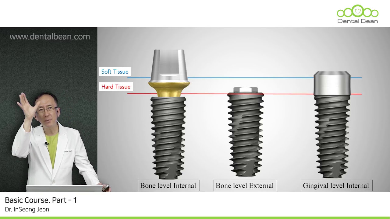 [#Dentalbean] Implant Basic Course Preview Lecture - YouTube