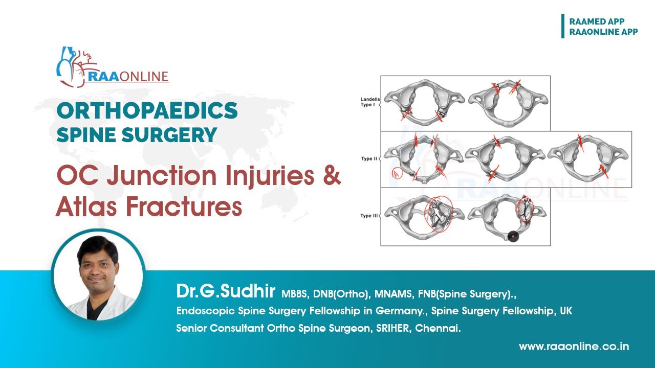 OC Junction injuries and Atlas Fractures - YouTube