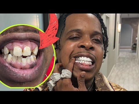 Finesse 2Tymes Put Da "Money Where His Mouth Is‼️ Before and After - YouTube