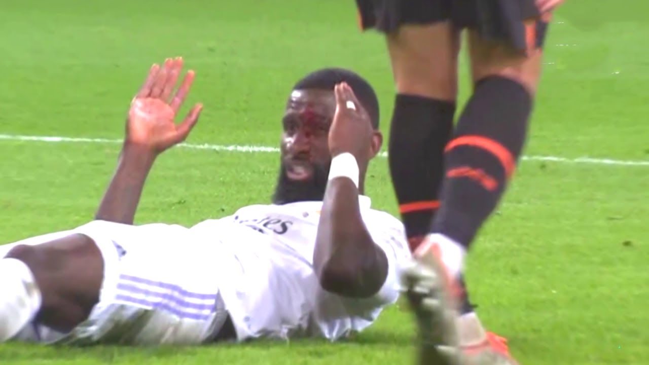 Así se vivieron los momentos de miedo en la lesión de Rudiger - YouTube