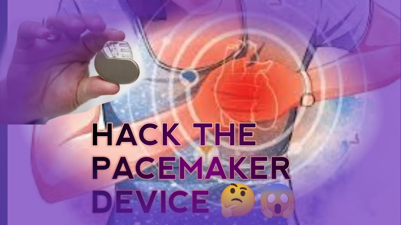 how hack pacemaker 😱पेसमेकर कैसे हैक करें 🤐#hack the #pacemaker# - YouTube