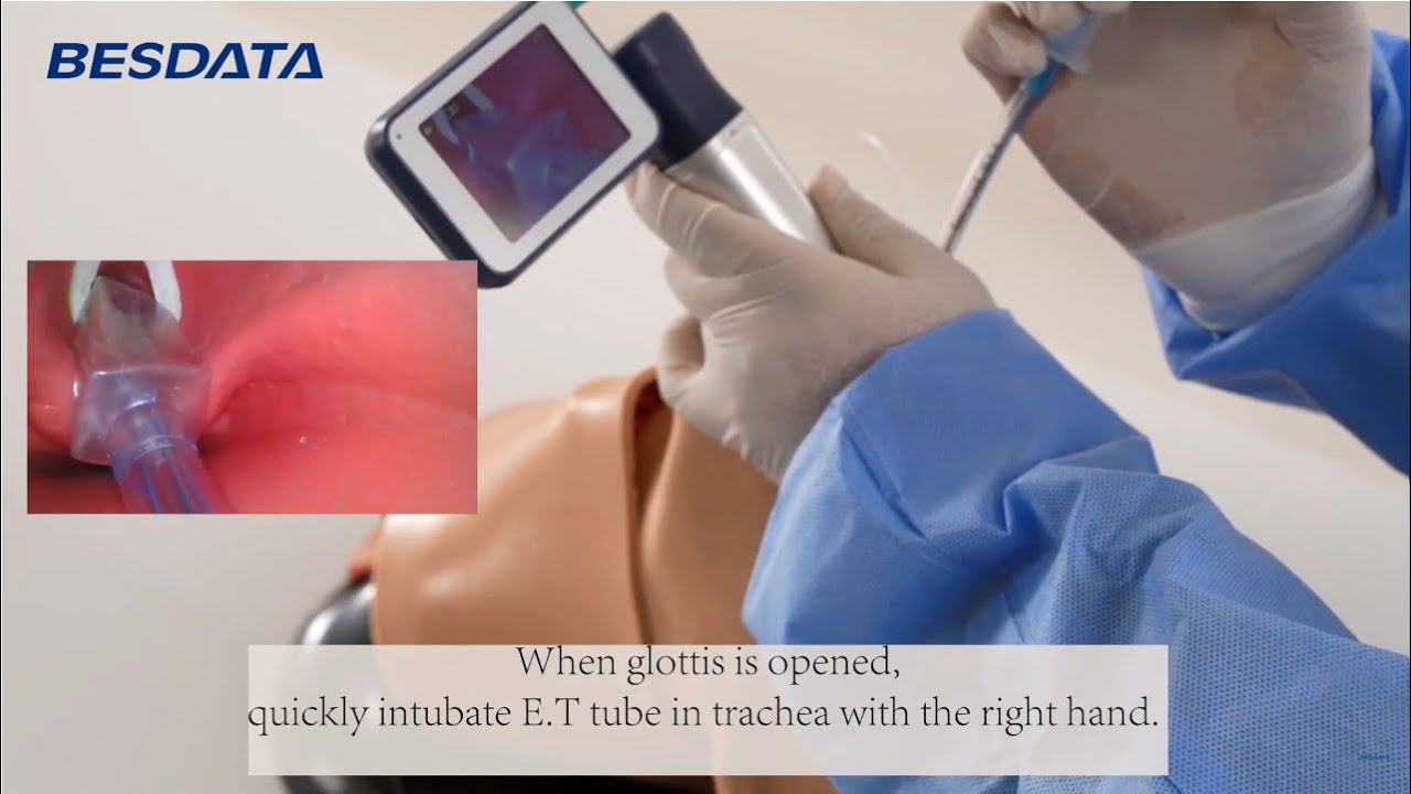 How to get the best view for airway intubation with video laryngoscope ...
