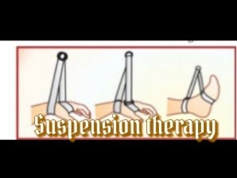 Suspension Therapy | Types & Principle of Suspension Therapy |Treatment ...