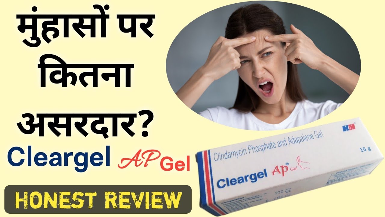 Cleargel AP Gel How To Use For Clear Skin In Hindi | Clear Gel AP Best ...
