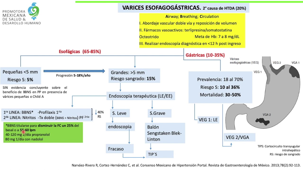 Várices esofágicas - YouTube