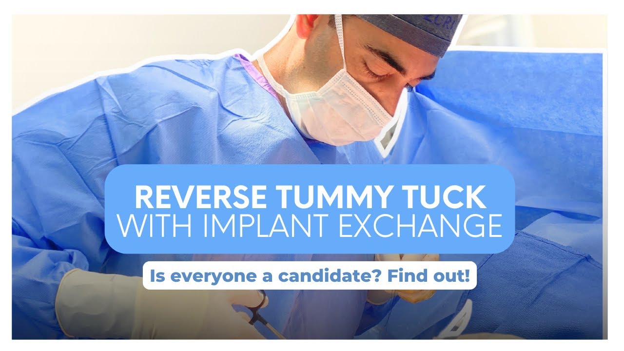Reverse Tummy Tuck with Implant Exchange Dr. Zuri in Miami | Zuri ...