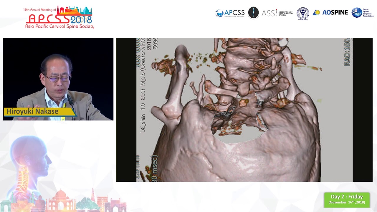 Neurosurgical virtual reality simulation in cranio-vertebral junction ...