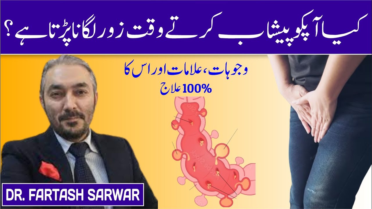 Bladder Diverticula | Peshab Ka Ruk Ruk Kar Aana | Causes & Treatment ...