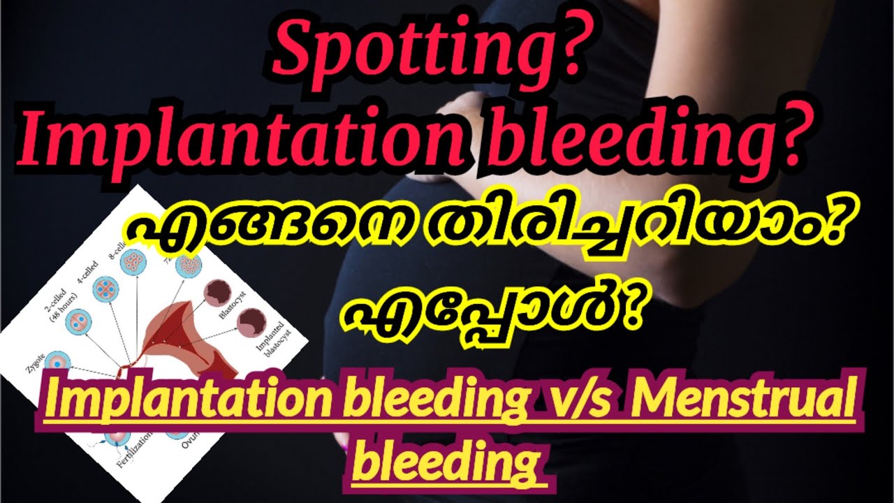 Spotting and Implantation bleeding | Implementation bleeding in ...