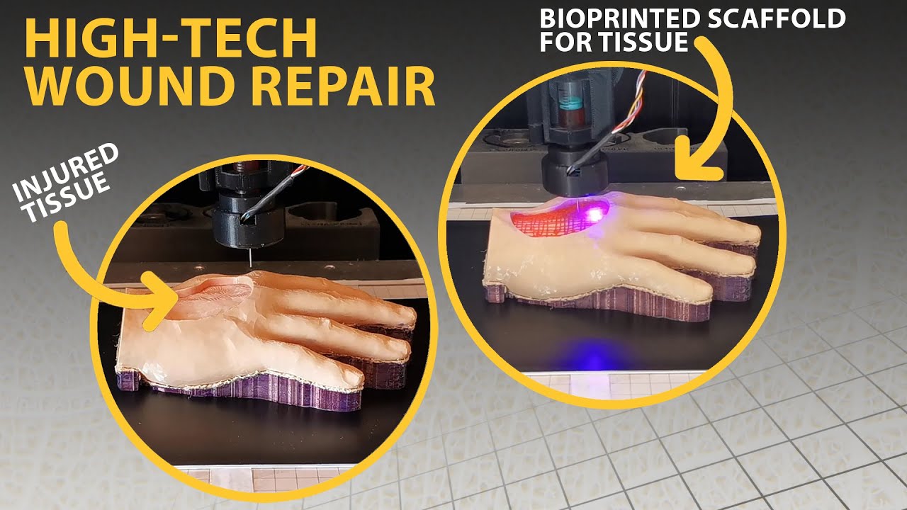 3D bioprinting to help heal wounds | Headline Science - YouTube