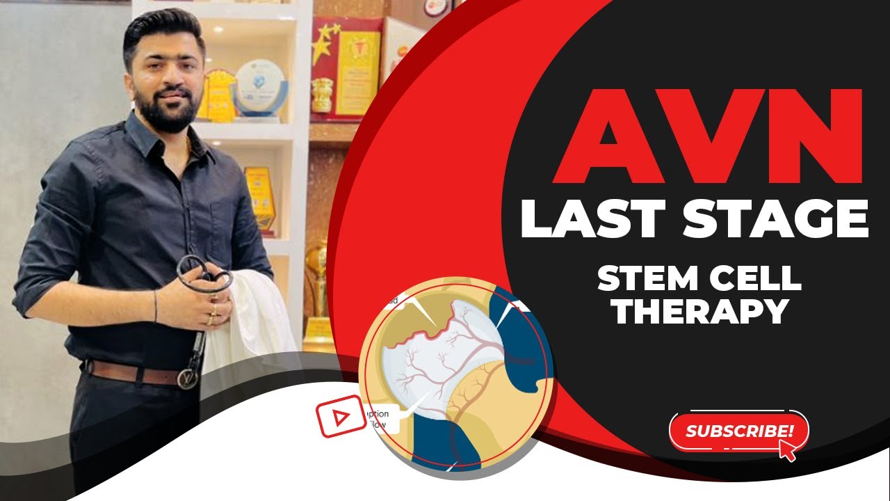 AVN Last stage |Osteonecrosis| Core Decompression |Stem cell therapy ...