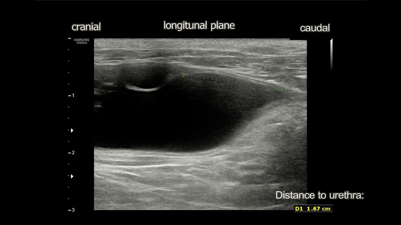 Urinary bladder mass with cysts in a cat - YouTube