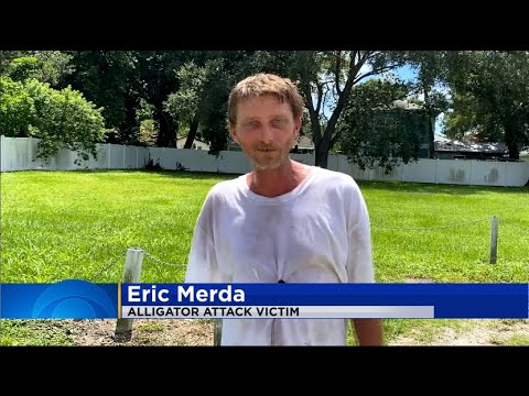 Florida Man Loses Arm In Alligator Attack, Wanders Swamp For Three Days ...