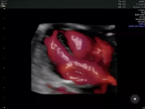 The Relationship Between an OB and Perinatologist - YouTube