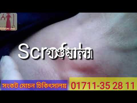 Scrofula - YouTube