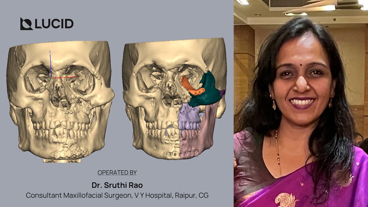 Restoring Form and Function | A Case Study of Multi-Stage ...