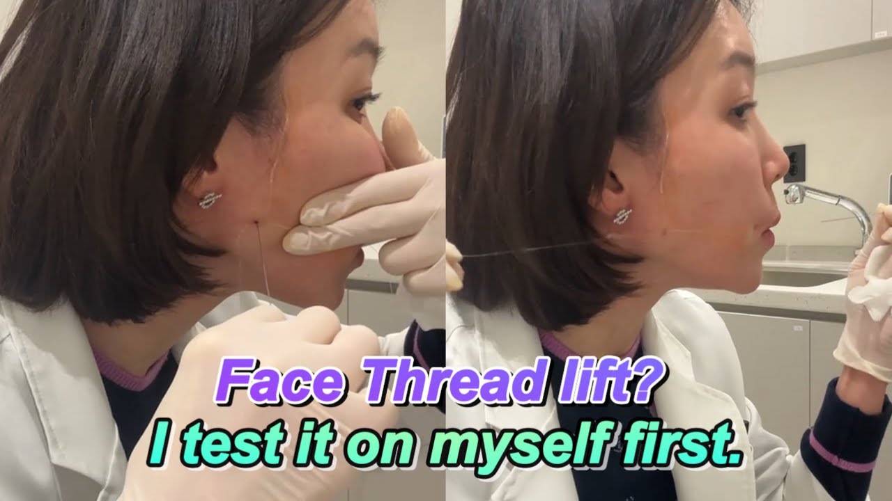 Doctor Performs Self face Thread Lift | Real Korean Lifting - YouTube