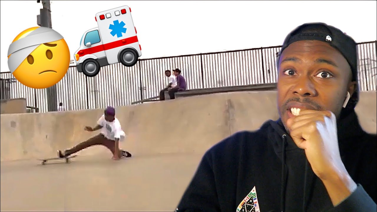 My Worst Skateboarding Injury! Q&A - YouTube